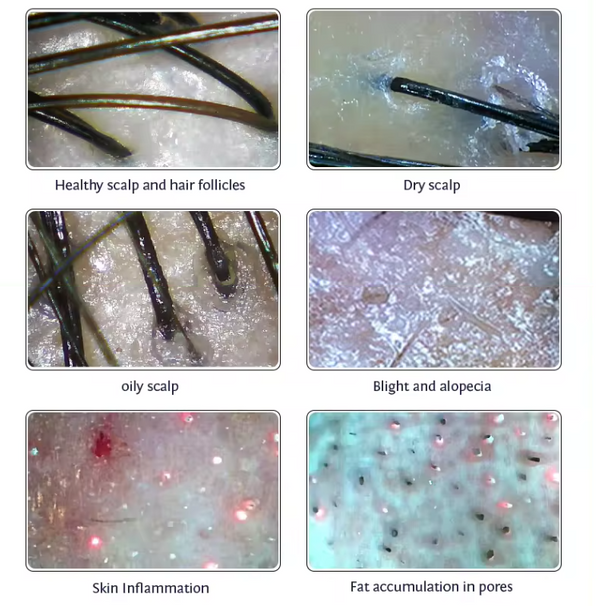 Digital Desktop 11-inch HD Skin/Hair/Scalp Analysis/Detection Microsco ...